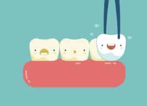 Dental Insurance Plans | Dental Coverage without waiting period | SHD